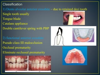 INTERCEPTIVE ORTHODONTICS.pptx