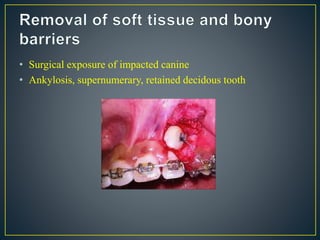 INTERCEPTIVE ORTHODONTICS.pptx