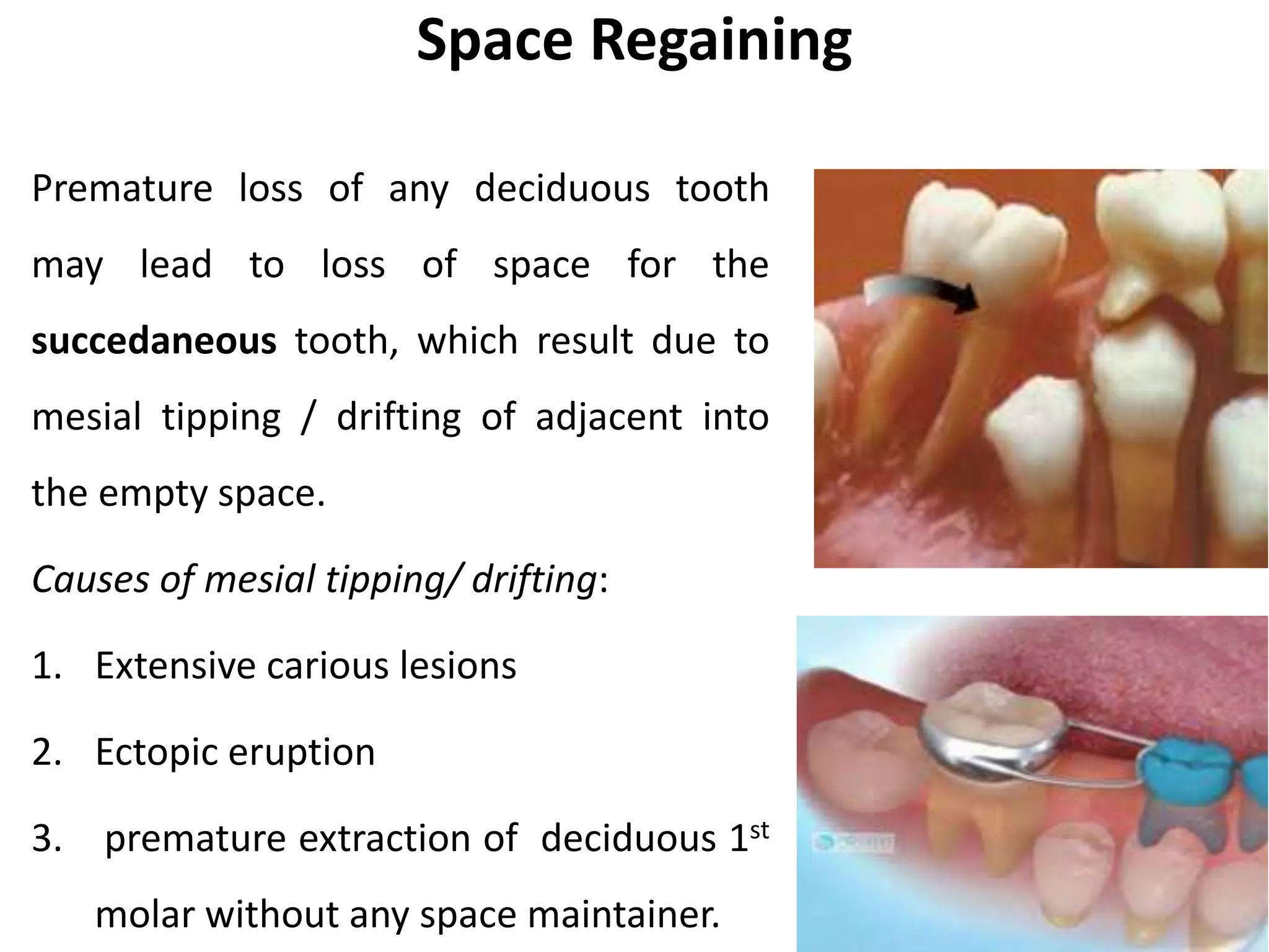 Interceptive orthodontics lecture 3 | PPTX