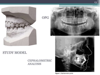 Interceptive Orthodontics by Malik Abdul | PPTX