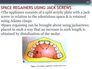Interceptive Orthodontics by Malik Abdul | PPTX