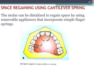 Interceptive Orthodontics by Malik Abdul | PPTX