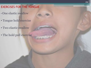 Interceptive Orthodontics by Malik Abdul | PPTX