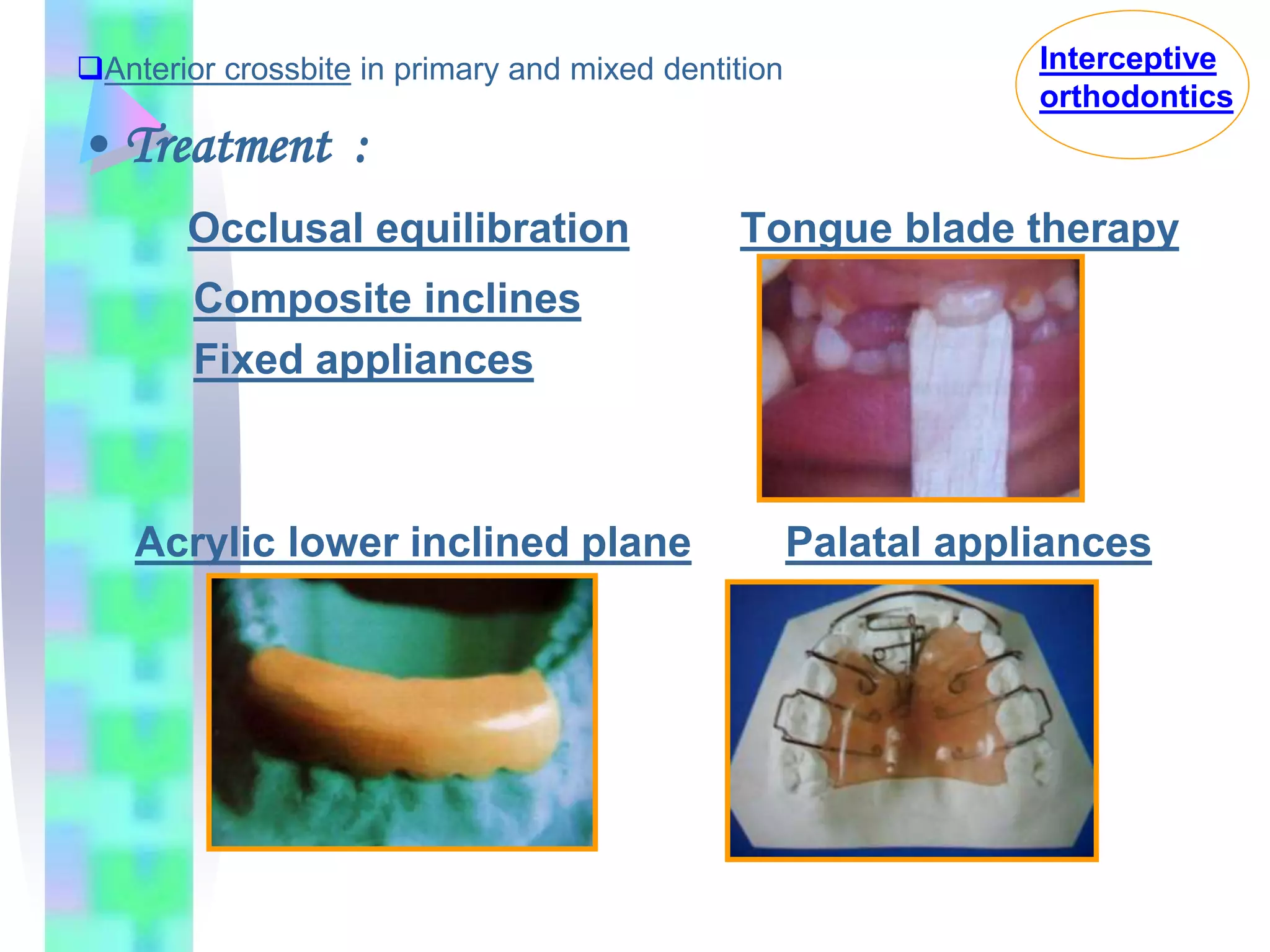 Interceptive Orthodontics O.ppt