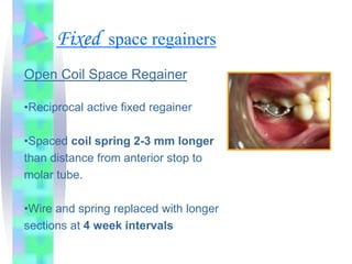Interceptive Orthodontics O.ppt
