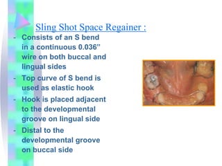 Interceptive Orthodontics O.ppt