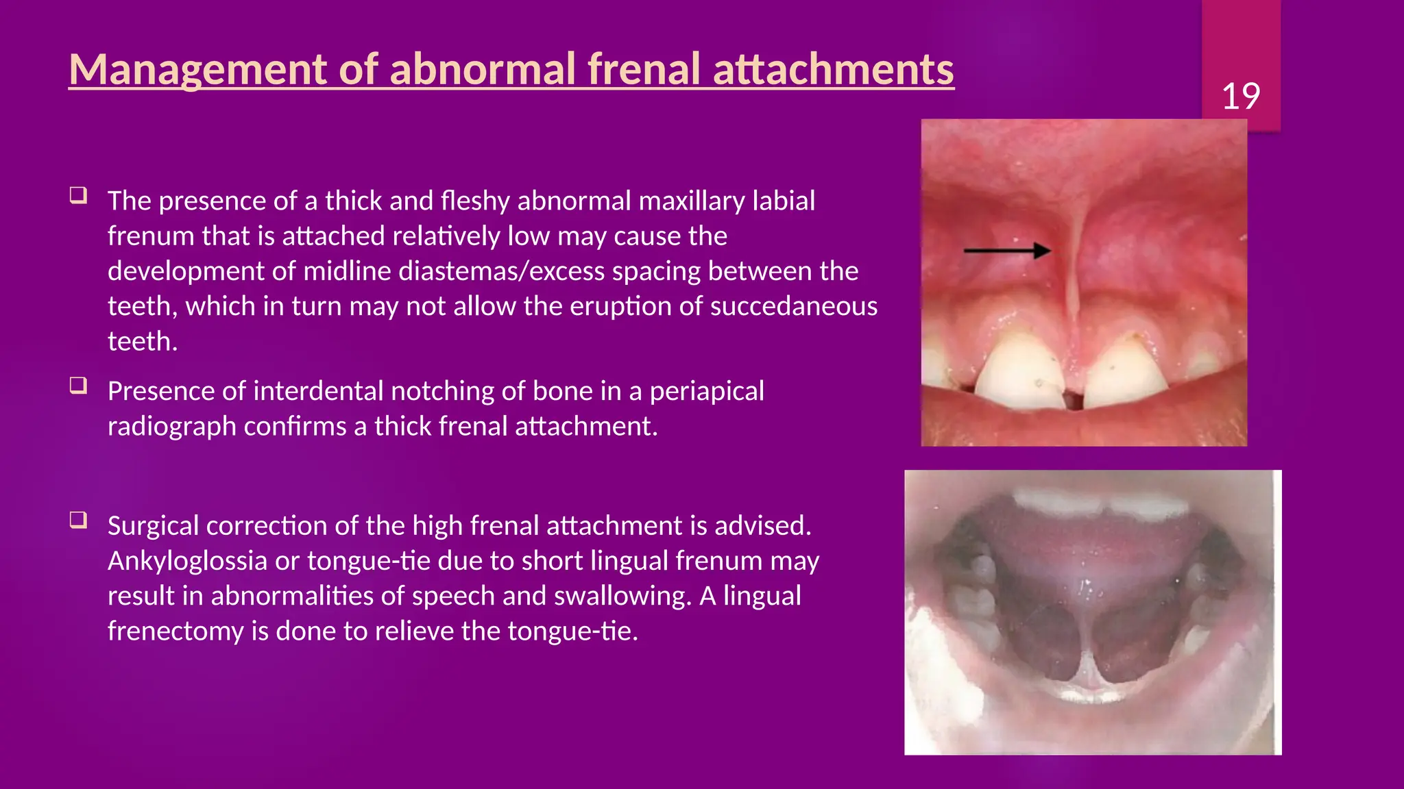 Preventive & Interceptive Orthodontics Basics | PPTX