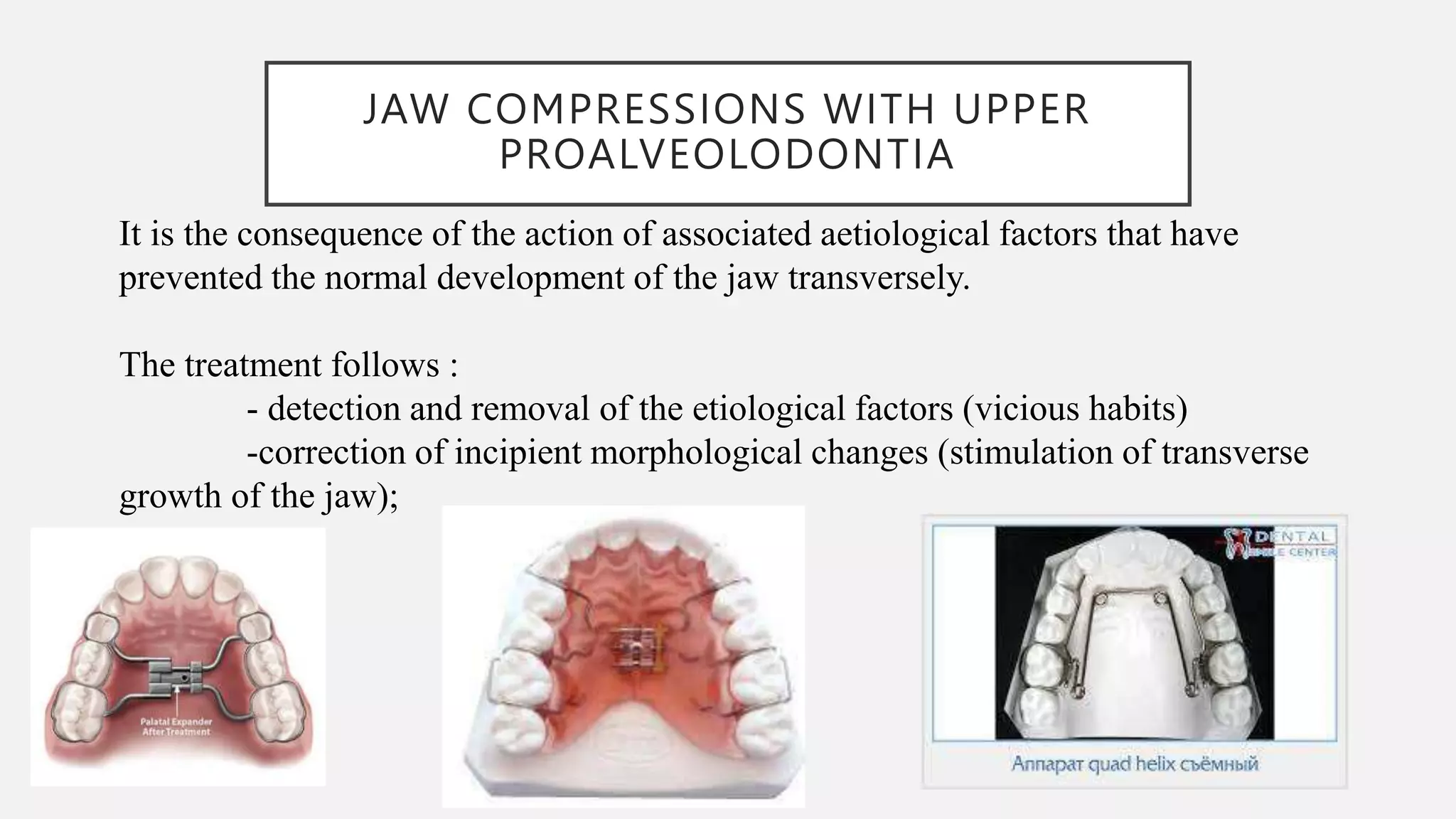 interceptive treatmenrt .pptx