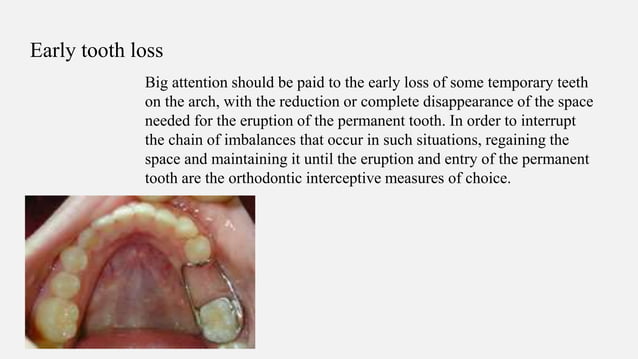 interceptive treatmenrt .pptx