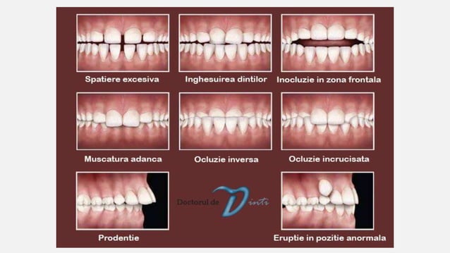 interceptive treatmenrt .pptx