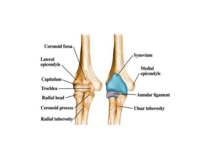 Intercondylar fracture of humerus | PPTX