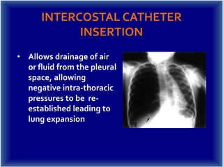Intercostal catheter insertion | PPT