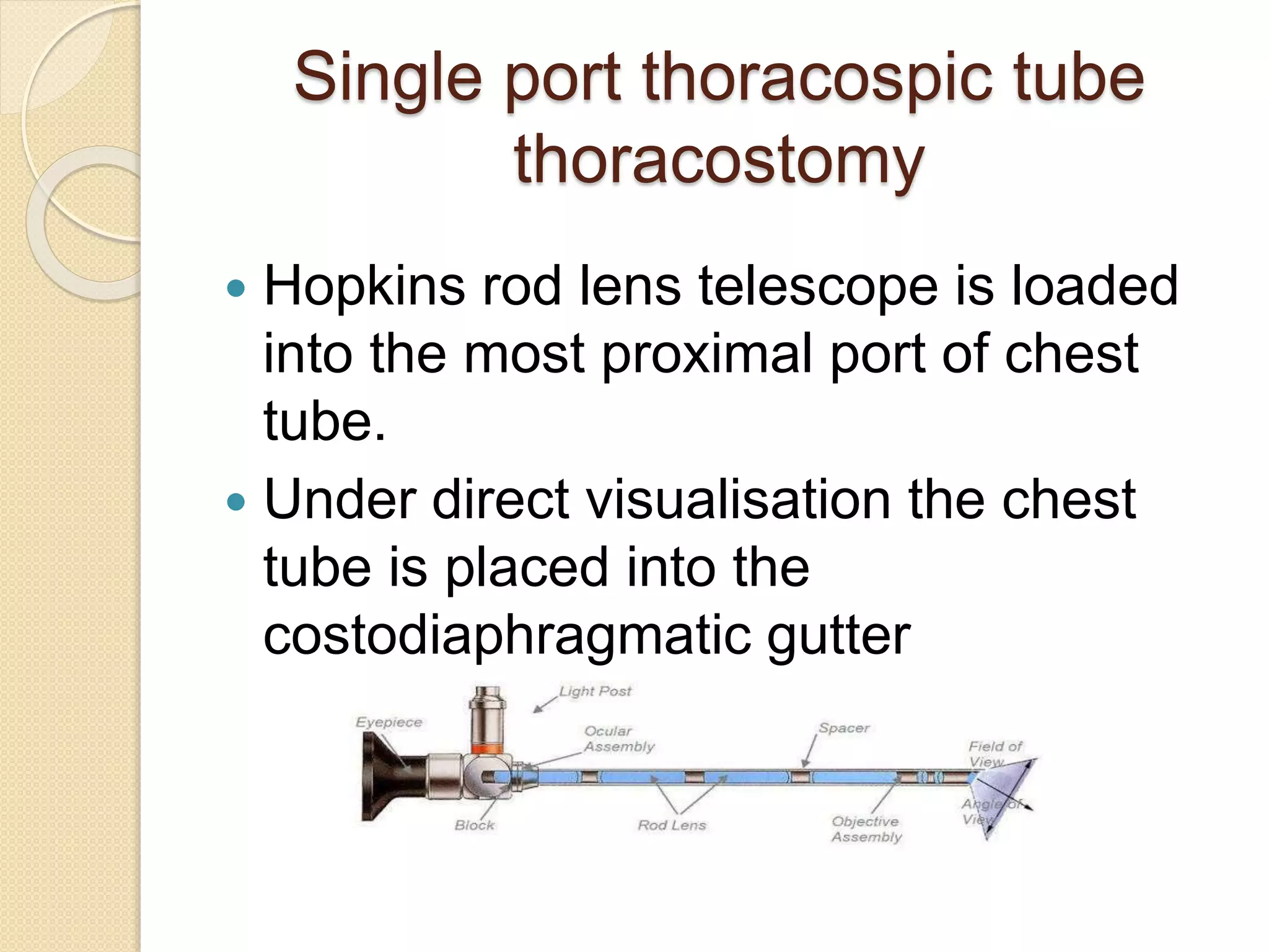 Intercostal drainage | PPTX