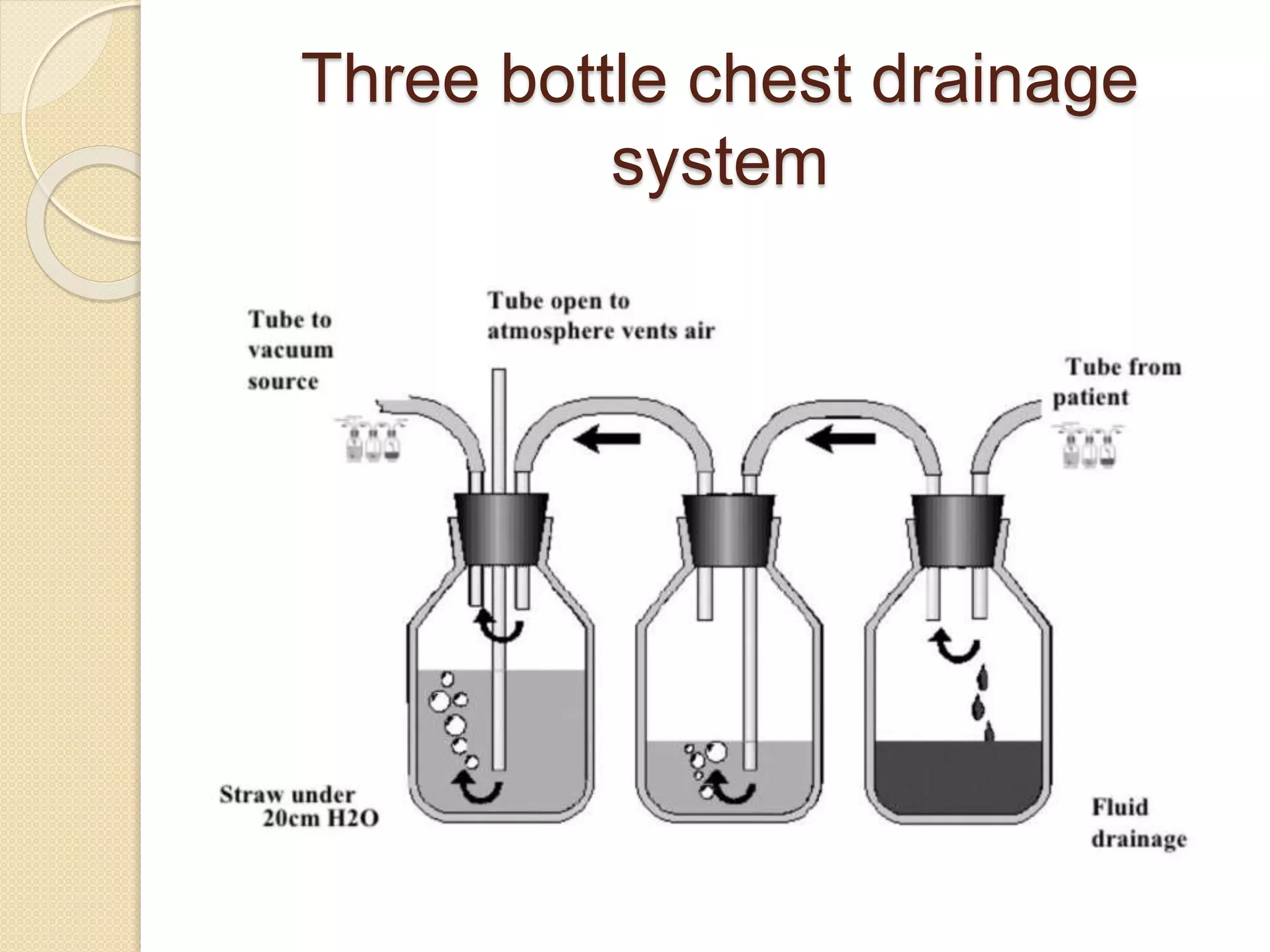 Intercostal drainage | PPTX