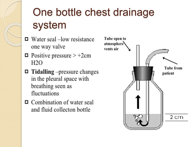 Intercostal drainage | PPTX