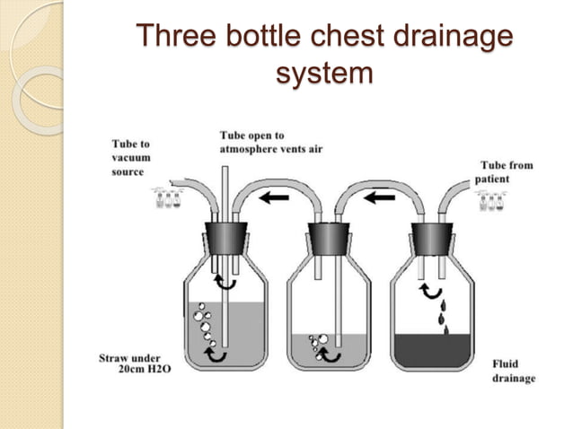 Intercostal drainage | PPTX