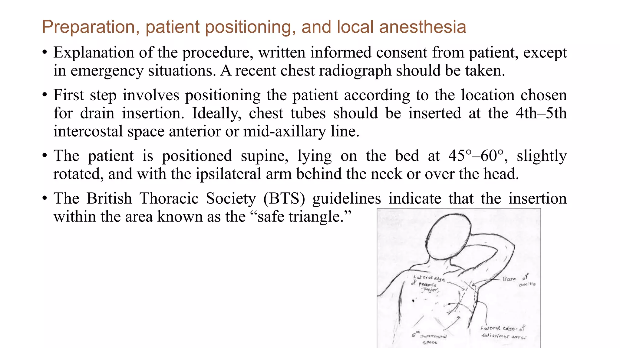 Intercostal drainage tube | PPTX