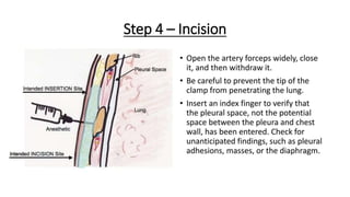 Intercostal Tube Drainage - history ,indications | PPTX