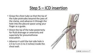 Intercostal Tube Drainage - history ,indications | PPTX