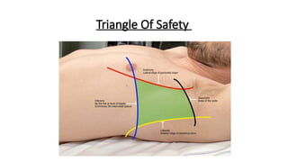 Intercostal Tube Drainage - history ,indications | PPTX