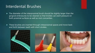 Interdental aids | PPTX