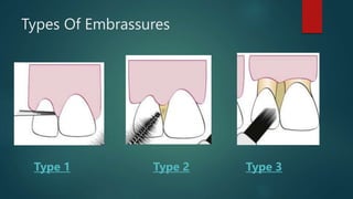Interdental aids | PPTX