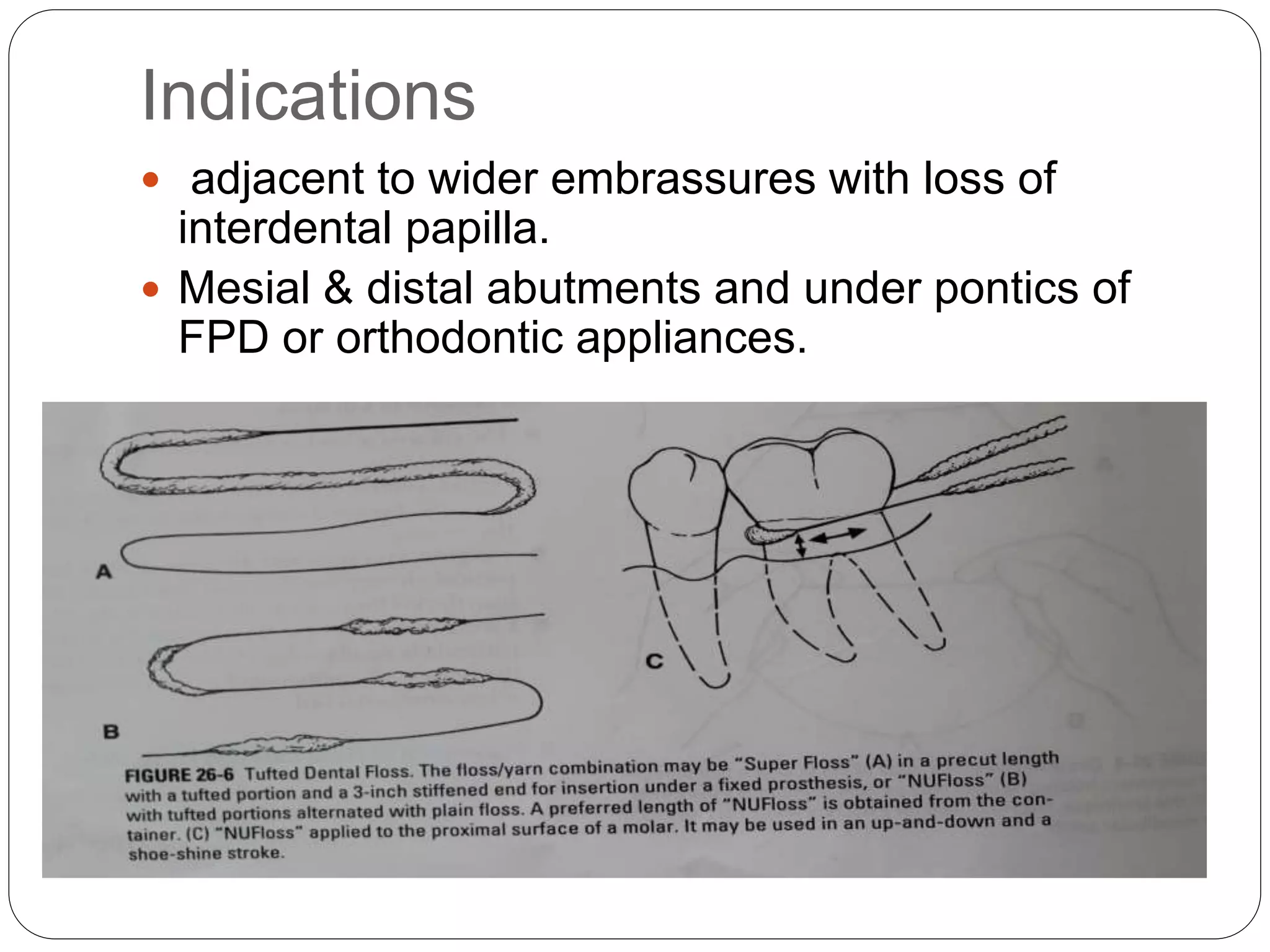 Interdental aids powerpoint presentation | PPTX