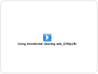 Interdental aids powerpoint presentation | PPTX