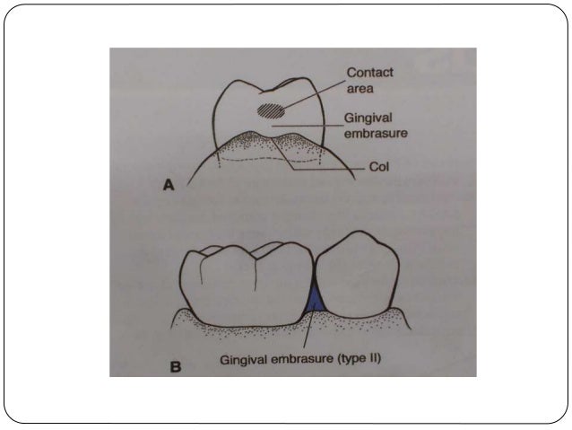 Interdental aids powerpoint presentation