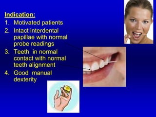 Interdental cleaning devices | PPT