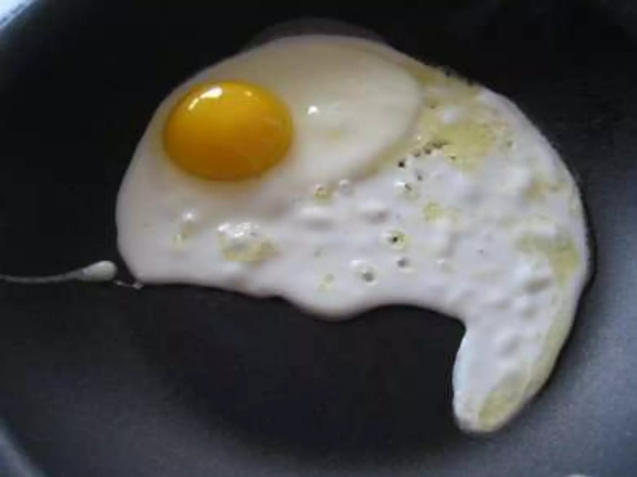 Interdental Wiring for Mandibular Fracture Repair | PPTX