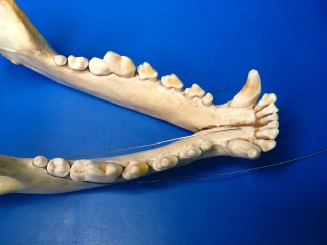 Interdental Wiring for Mandibular Fracture Repair | PPT