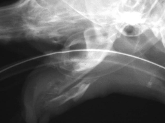 Interdental Wiring for Mandibular Fracture Repair | PPTX | Dental ...