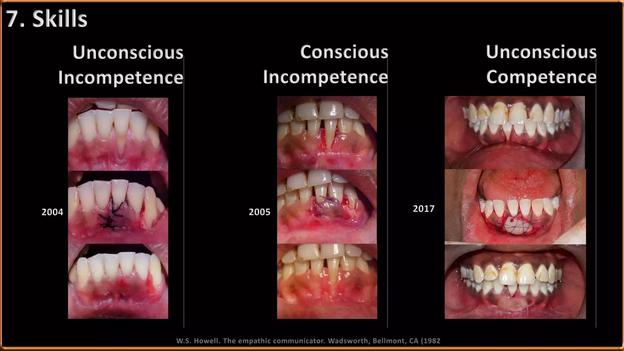 Interdisciplinary periodontics | PPTX