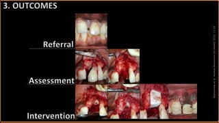 Interdisciplinary periodontics | PPTX