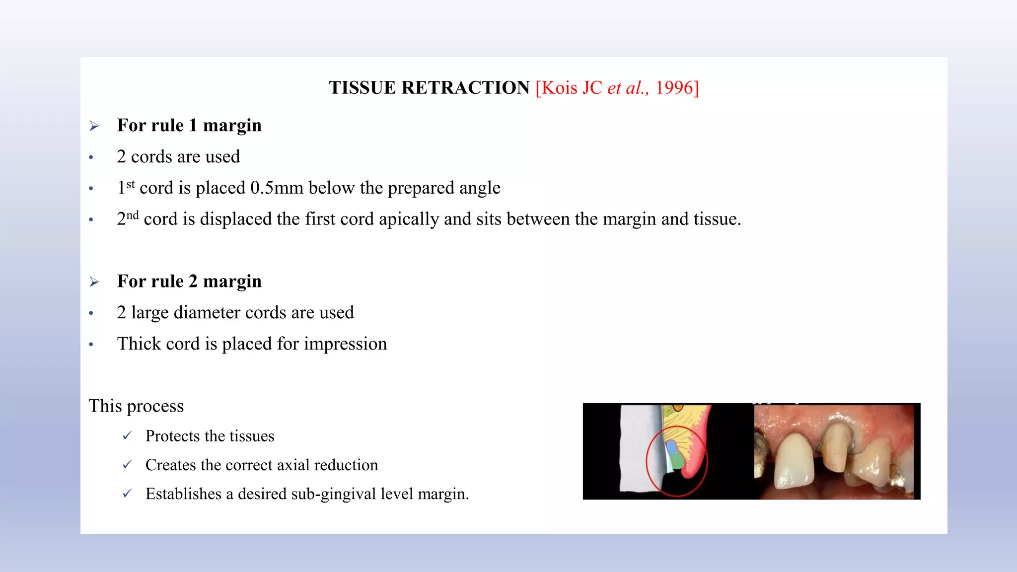 Interdisciplinary periodontics | PPTX