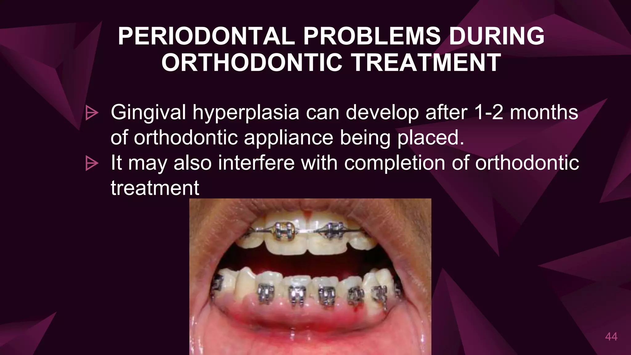Interdisciplinary Periodontics ppt.pptx