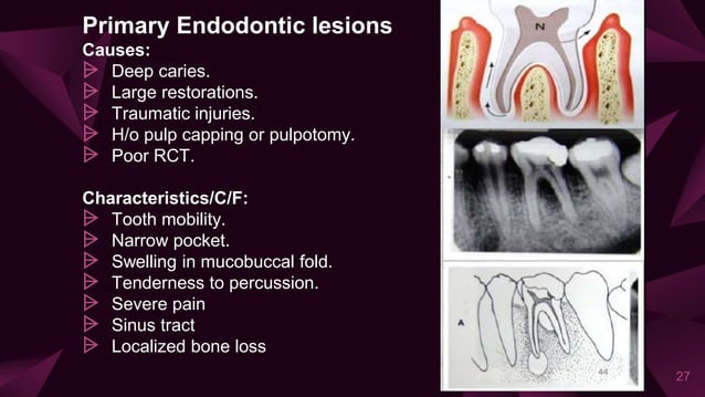 Interdisciplinary Periodontics ppt.pptx | Dental Health | Diseases and ...