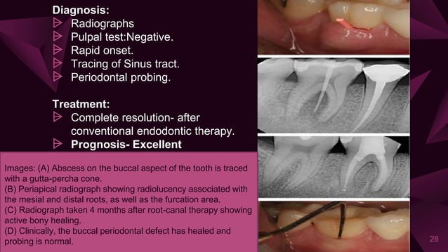 Interdisciplinary Periodontics ppt.pptx | Dental Health | Diseases and ...