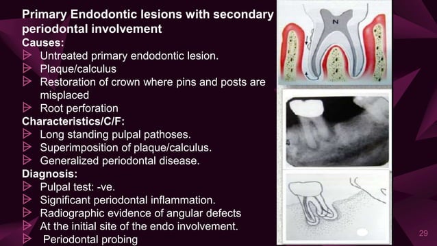 Interdisciplinary Periodontics ppt.pptx | Dental Health | Diseases and ...