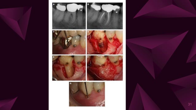 Interdisciplinary Periodontics ppt.pptx | Dental Health | Diseases and ...