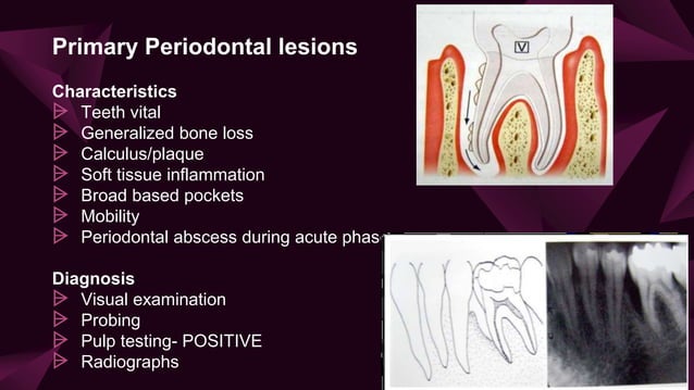 Interdisciplinary Periodontics ppt.pptx | Dental Health | Diseases and ...