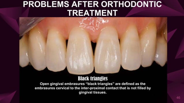 Interdisciplinary Periodontics ppt.pptx | Dental Health | Diseases and ...