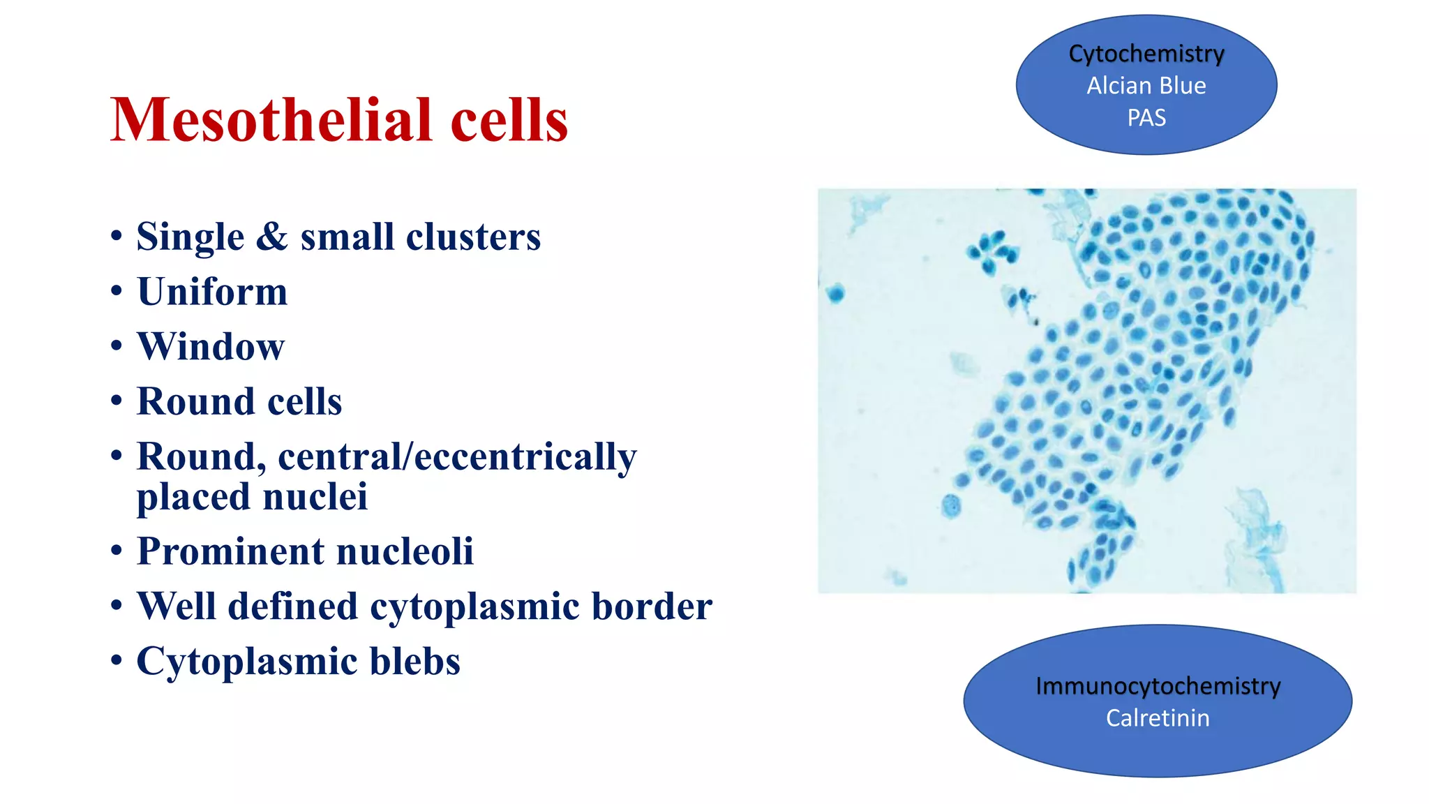 Pleura Cytology | PPTX