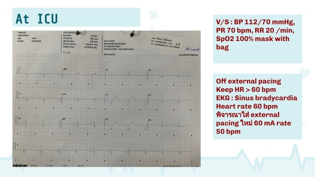 Interesting case ACLS.pdf