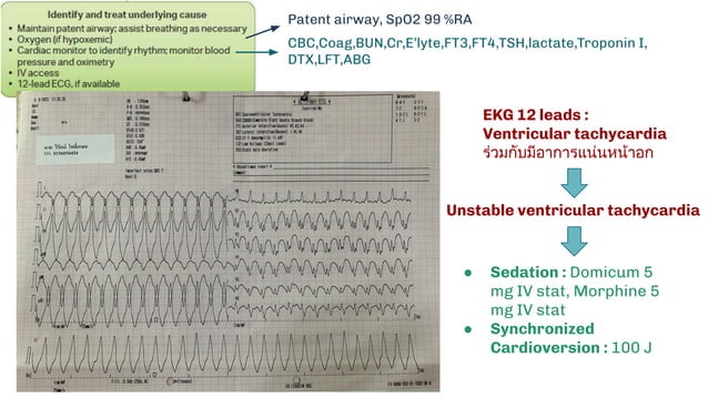 Interesting case ACLS.pdf