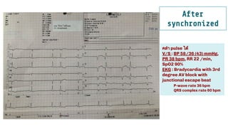 Interesting case ACLS.pdf