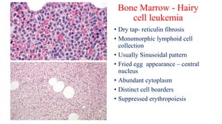 Lymphoma spillover.pptx