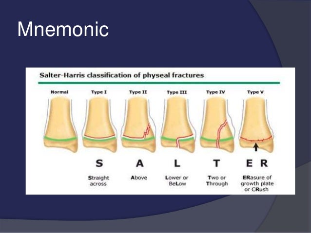 Interesting case epiphyseal plate injury