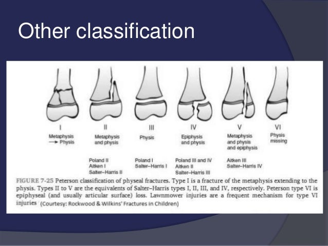Interesting case epiphyseal plate injury